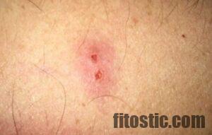 Comment Savoir Quel Type De Bouton