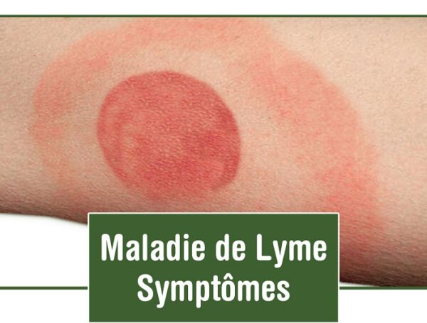 Comment faire partir les plaque rouge ? - Fitostic.com - Sport, Mode ...