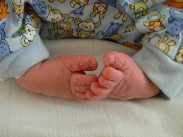 Comment guérir un pied bot ? - Fitostic.com - Sport, Mode, Beauté ...