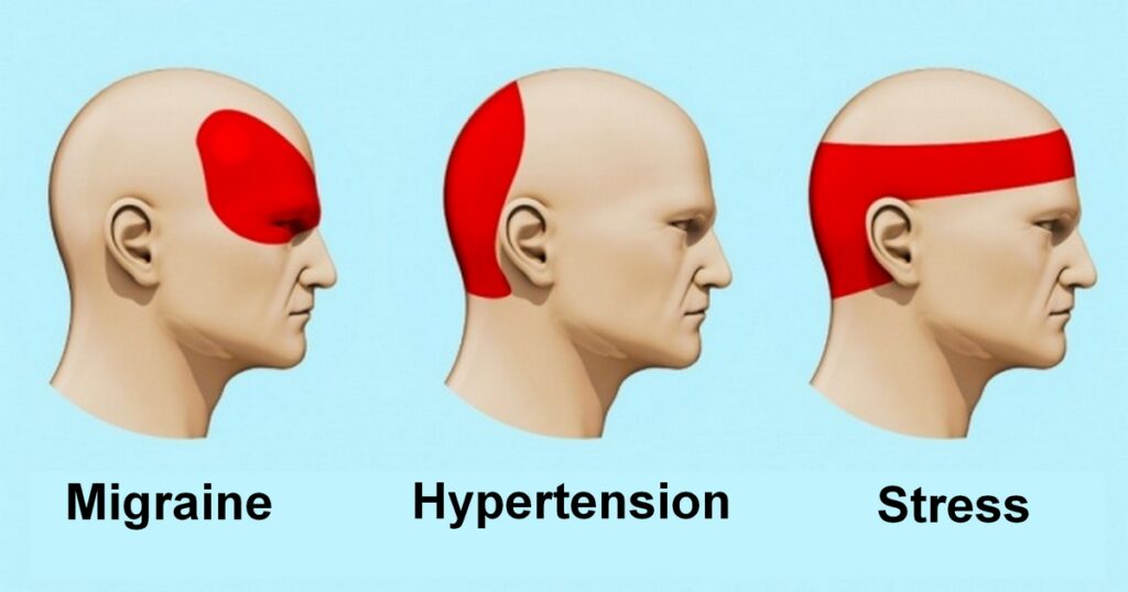 Comment se débarrasser d'un durillon ? - Fitostic.com - Sport, Mode ...