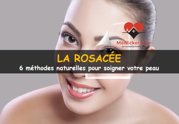 Comment soigner la rosacée du visage naturellement ? - Fitostic.com ...
