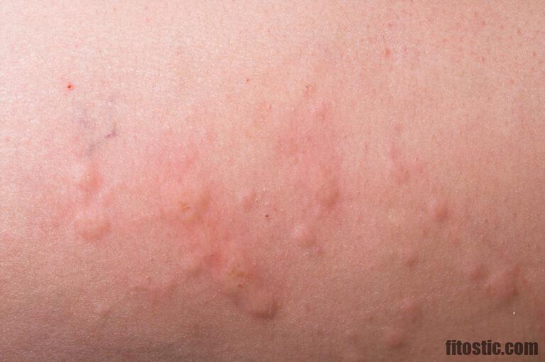 Tendances & Inspirations rubeole congenitale de la saison - Fitostic ...