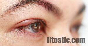 Qu'est-ce que des squames sur la peau ? - Fitostic.com - Sport, Mode ...