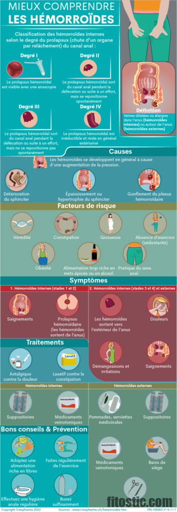 Comment soigner des hémorroïdes qui sortent