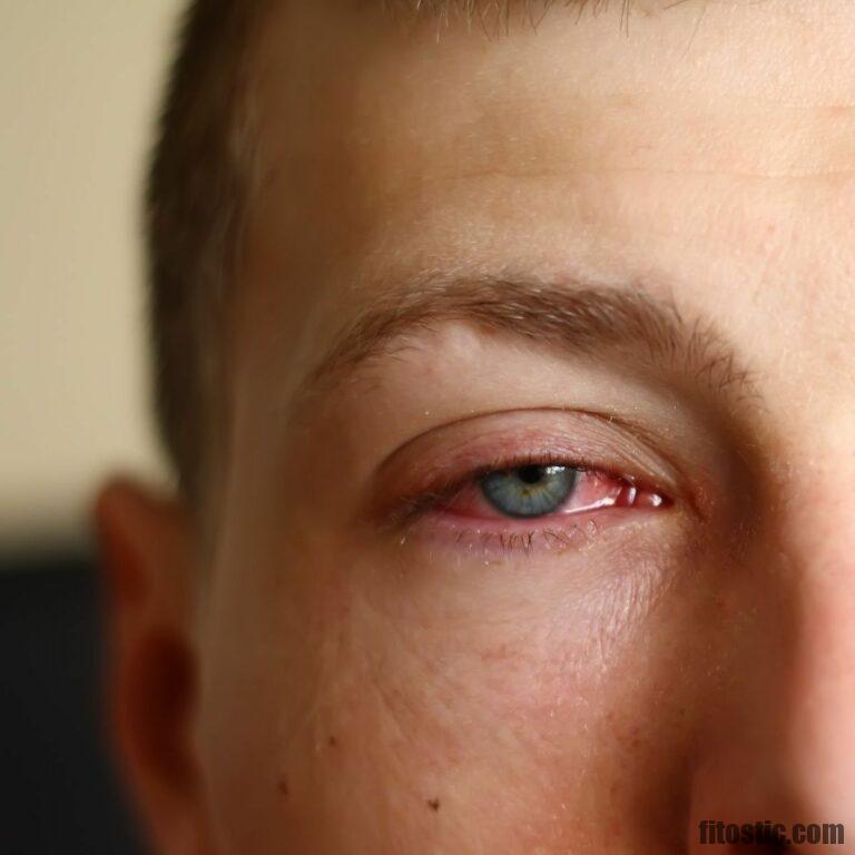 Quels sont les Premiers Signes de la Conjonctivite